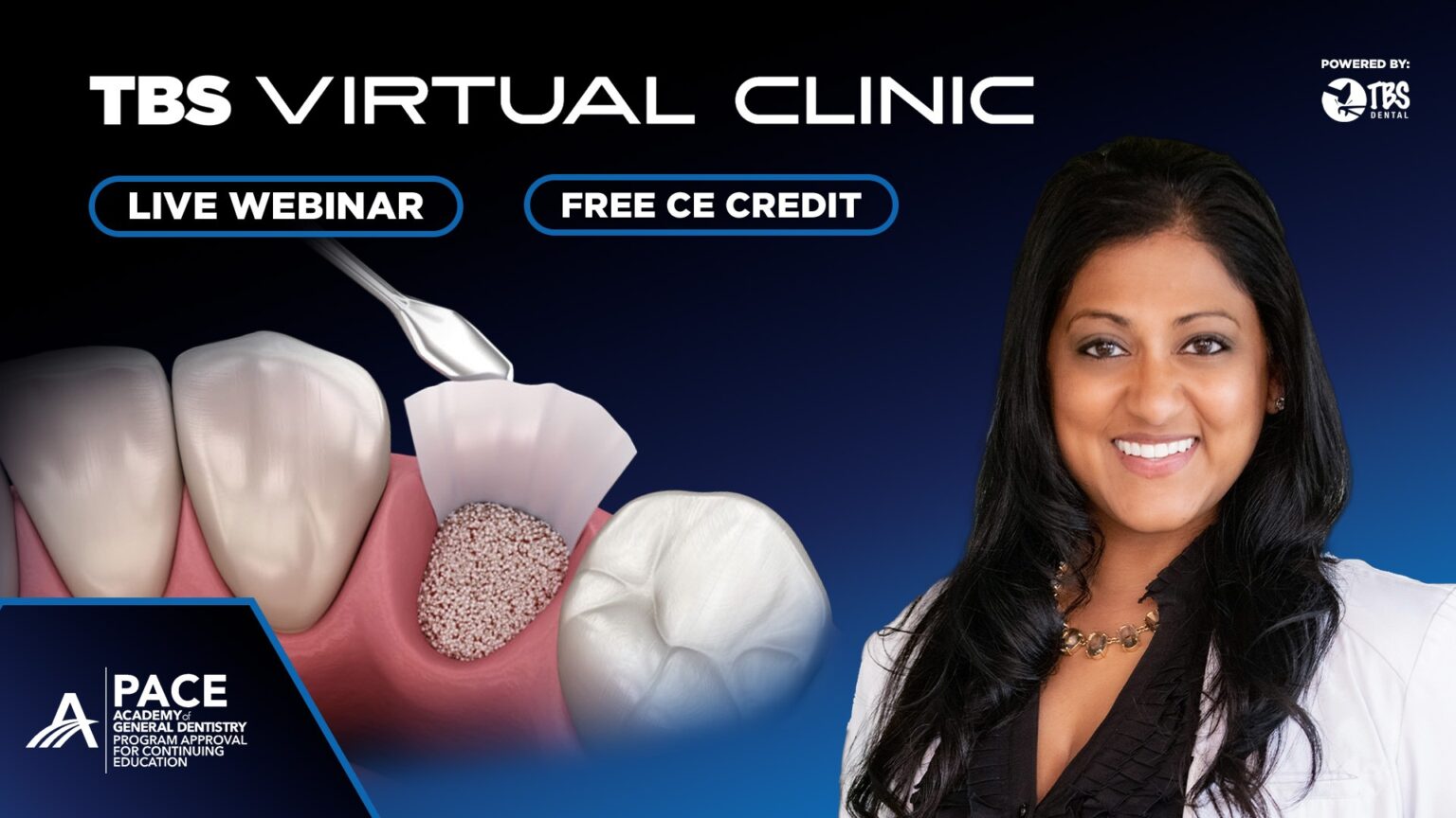 How to 10X Case Acceptance: Socket Preservation Procedures | TBS Dental